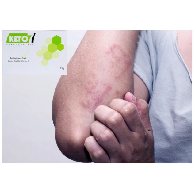 Keto 7 Antifungal Soap Bar 75gm EXP06/2025 - Farmasi Limbongan